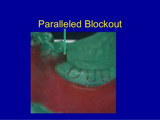27. rpd lab procedures