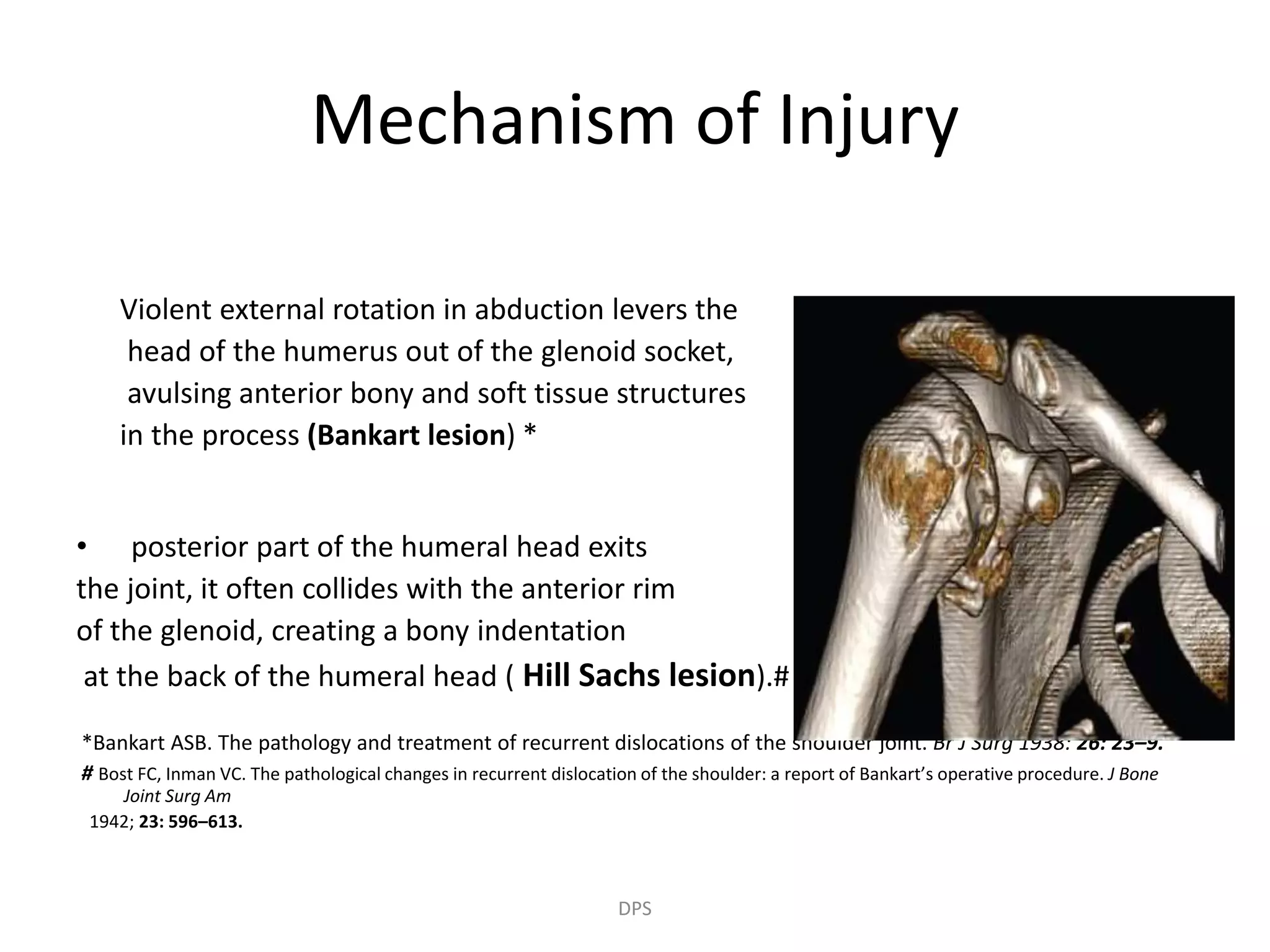 RECURRENT SHOULDER DISLOCATION. DR. DHARAMPAL SWAMI | PPTX