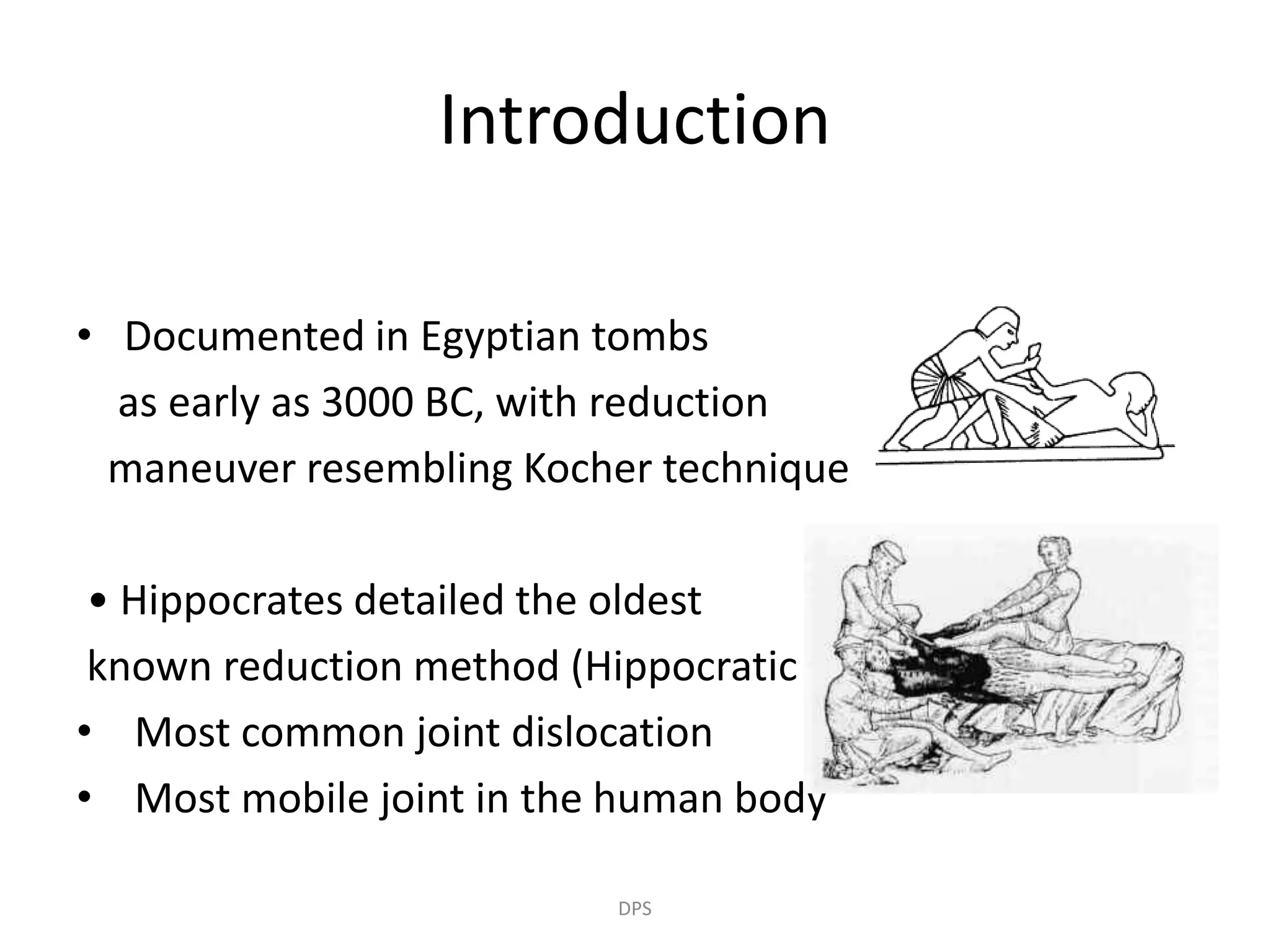 RECURRENT SHOULDER DISLOCATION. DR. DHARAMPAL SWAMI | PPTX