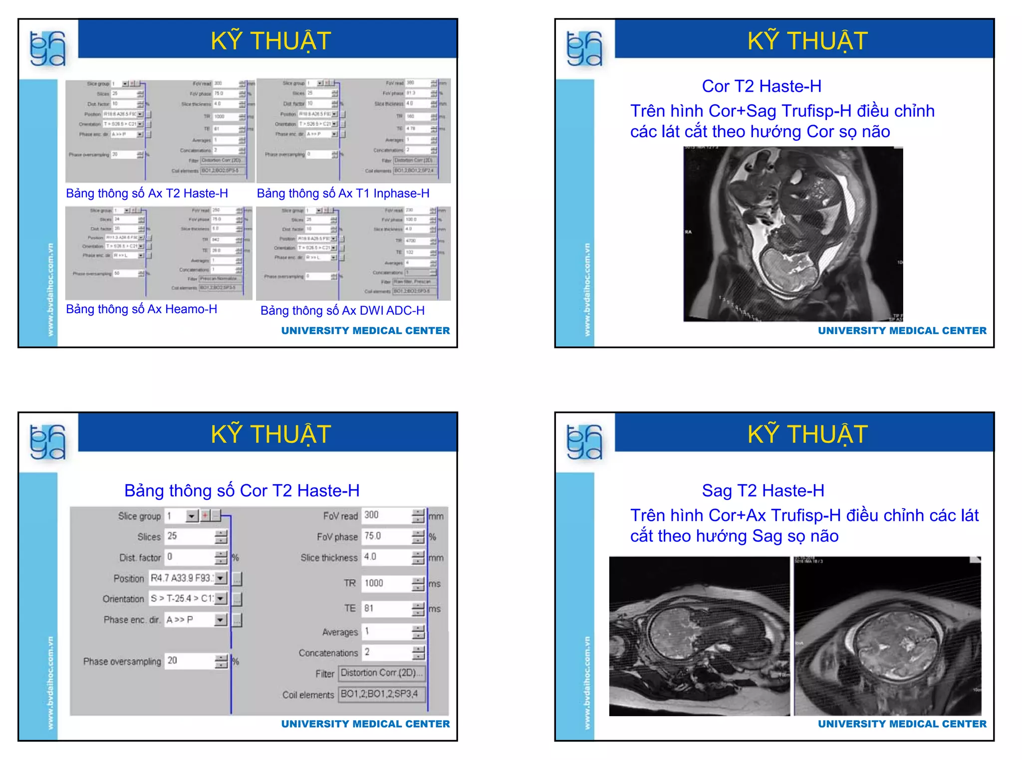 MRI thai nhi, Le Van Hau (VI) | PDF