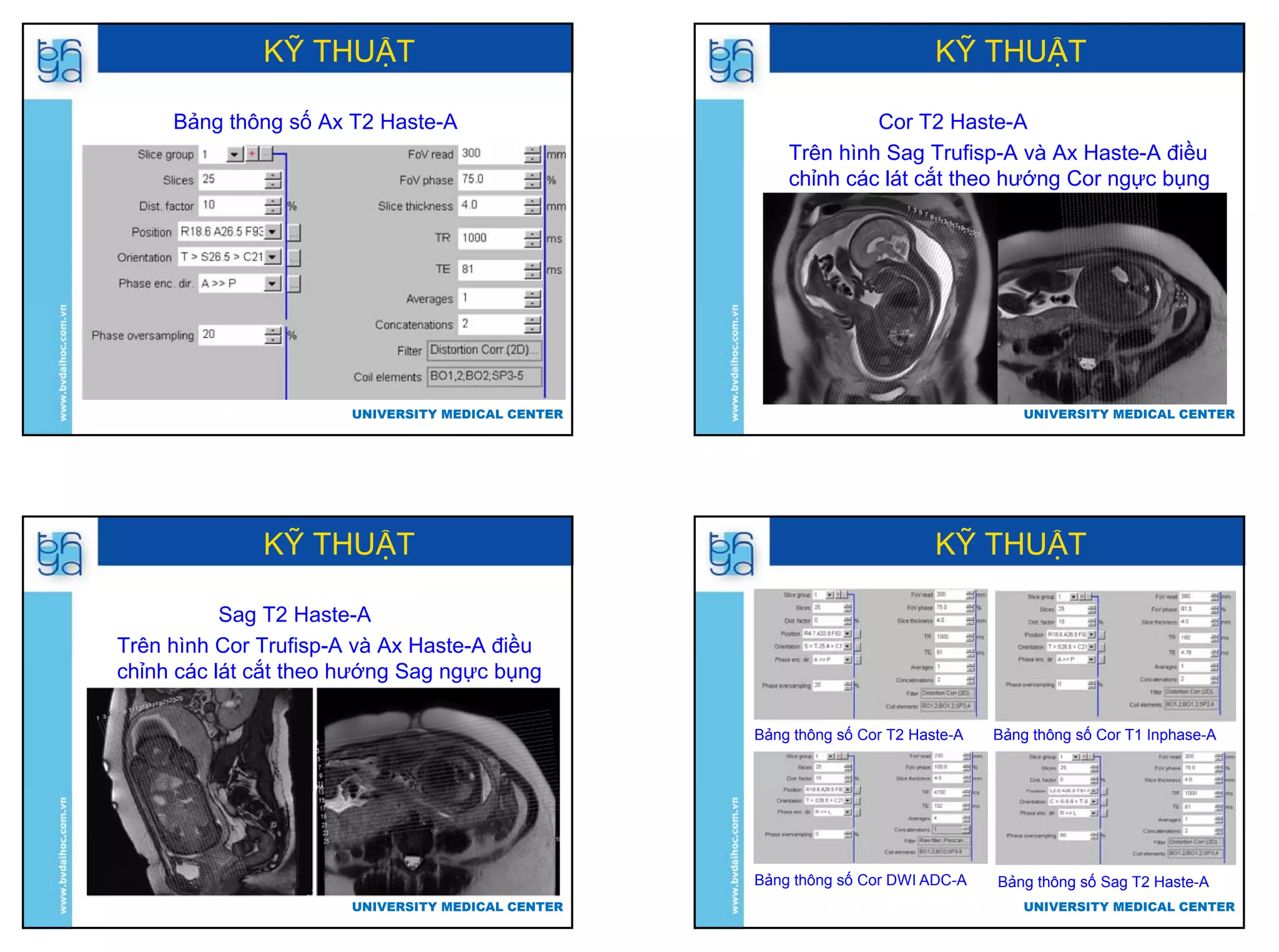 MRI thai nhi, Le Van Hau (VI) | PDF