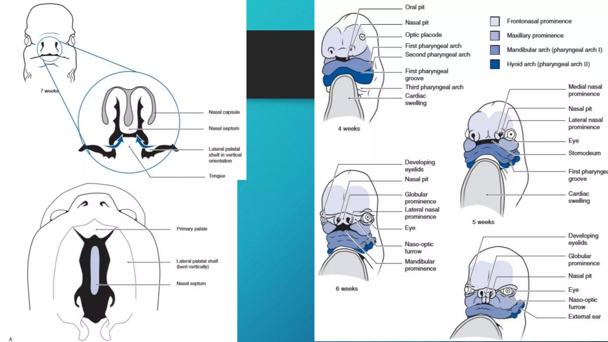 Orthognathic Surgery | PPTX