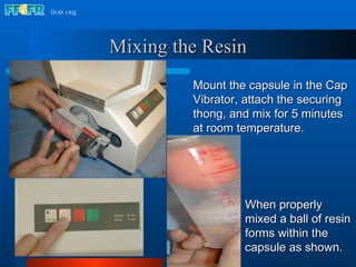 27.denture processing | PPT