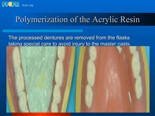 27.denture processing | PPT