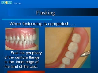 27.denture processing | PPT