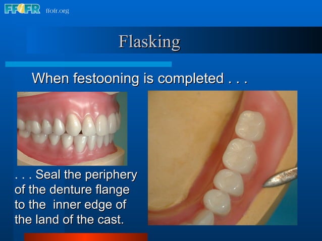 27.denture processing | PPT