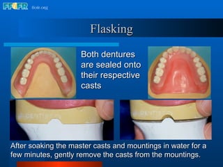 27.denture processing | PPT