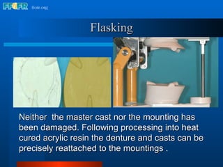 27.denture processing | PPT