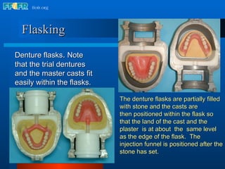 27.denture processing | PPT