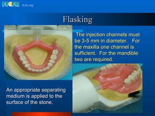 27.denture processing | PPT