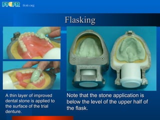 27.denture processing | PPT