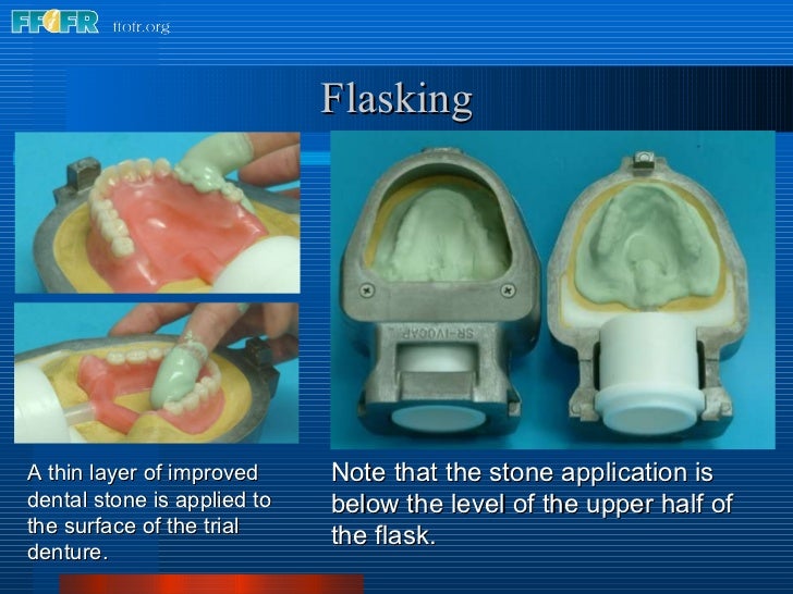 27.denture processing