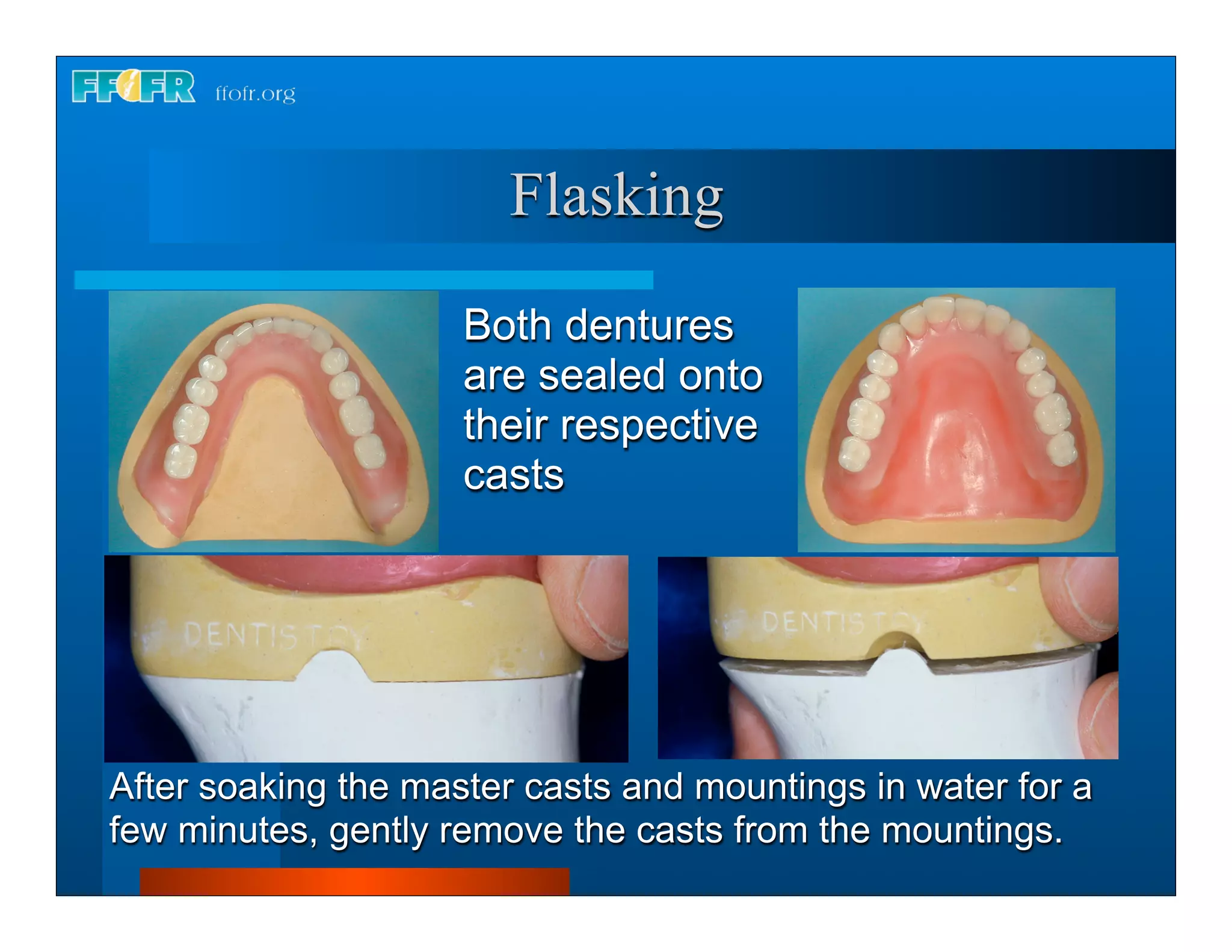 27.denture processing | PDF