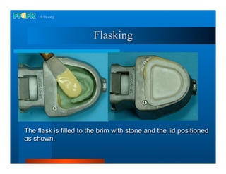 27.denture processing | PPT