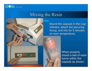 27.denture processing | PPT