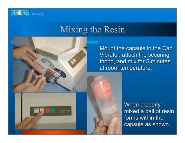 27.denture processing | PPT