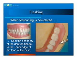 27.denture processing | PPT