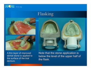 27.denture processing | PPT