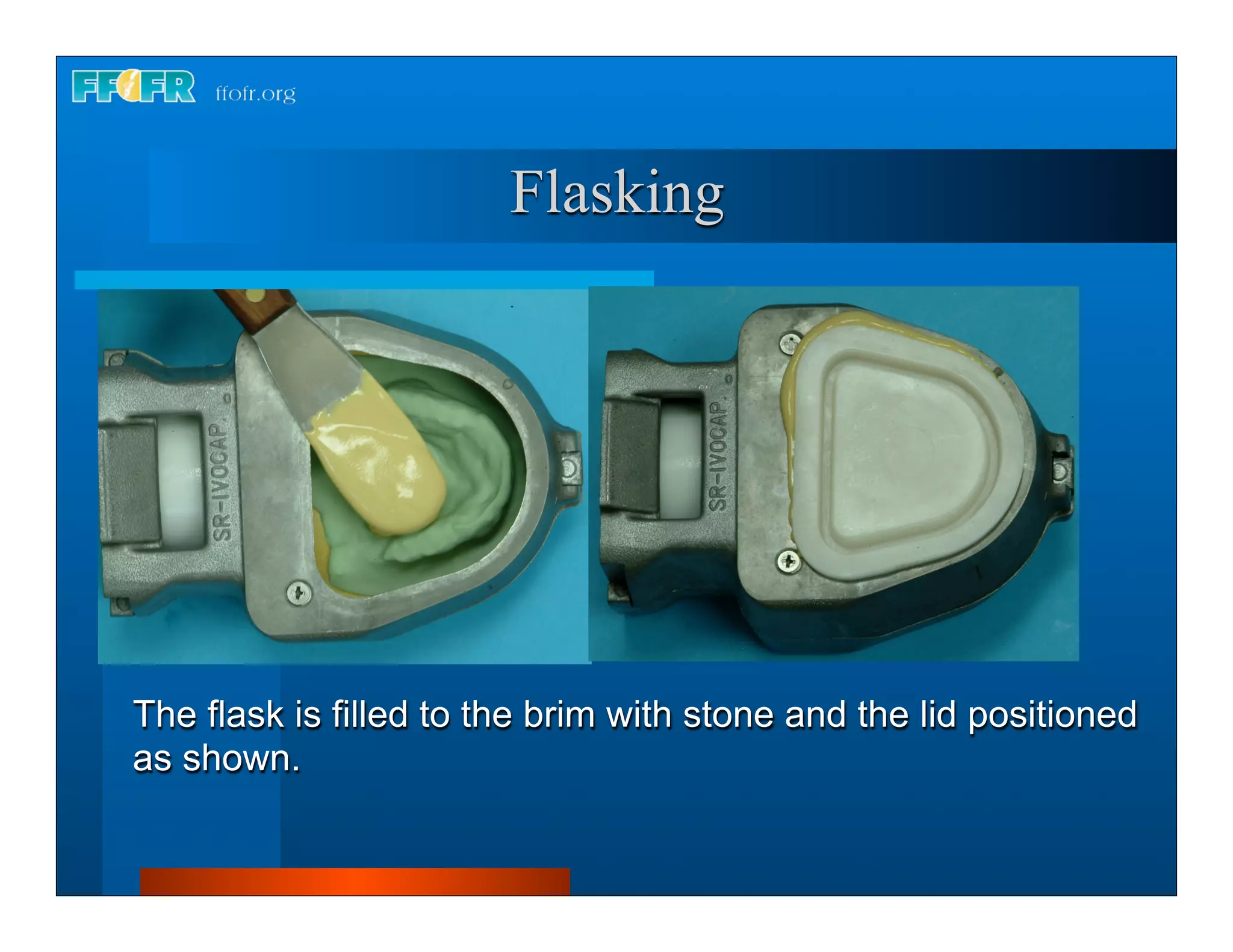27.denture processing | PDF