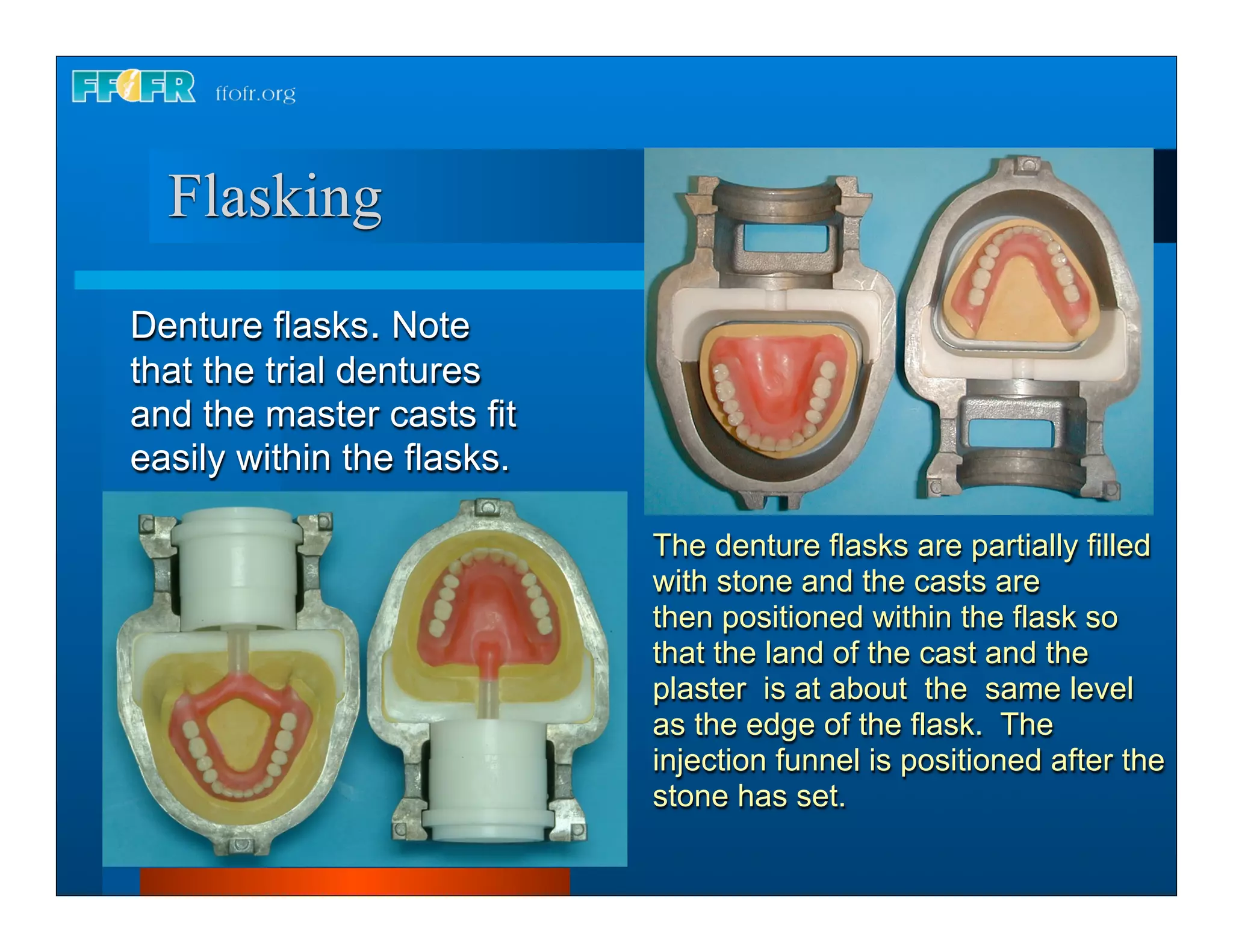 27.denture processing | PDF