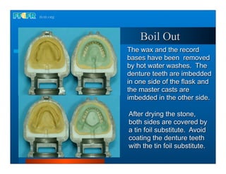 27.denture processing | PDF