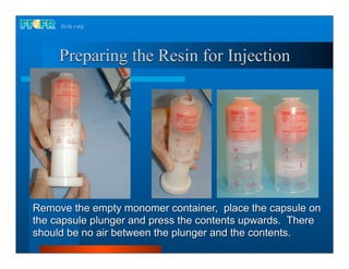 27.denture processing | PDF