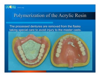 27.denture processing | PDF