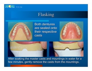 27.denture processing | PDF