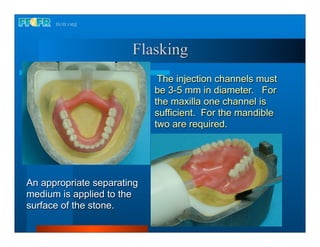 27.denture processing | PDF