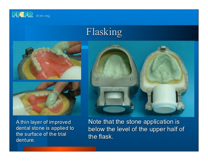 27.denture processing