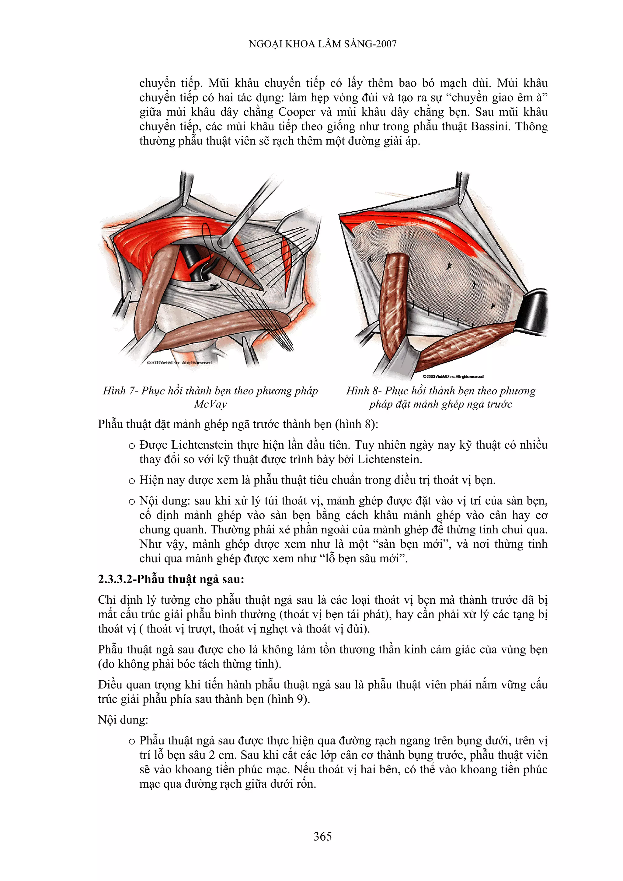 27 thoat vi thanh bung 2007 | PDF