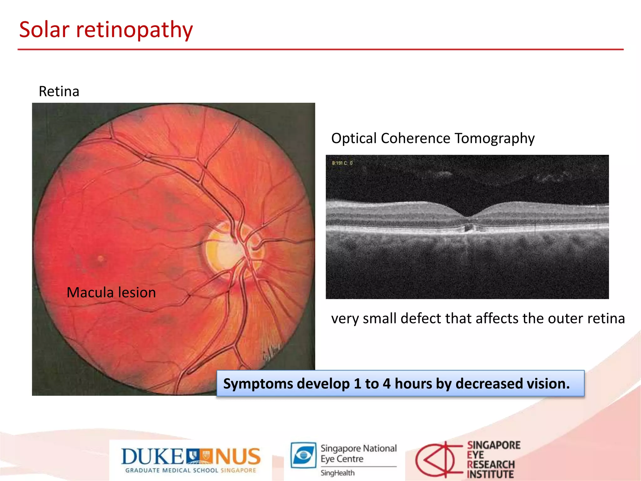 Visible light and the retina | PPTX