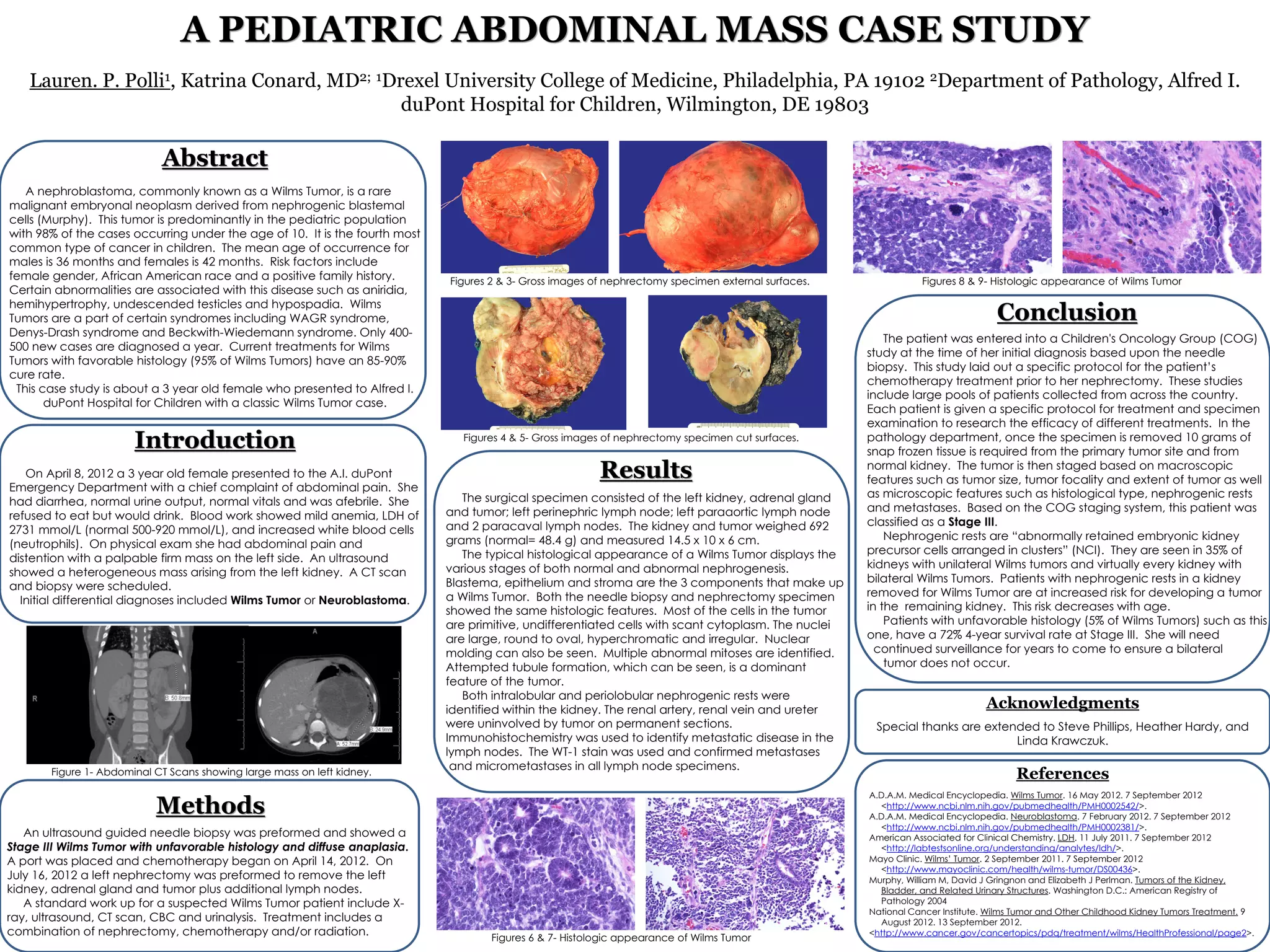 LPP_Poster_Wilms | PDF