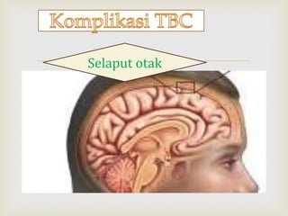 271308054-ppt-penyuluhan-tbc-ppt.ppt