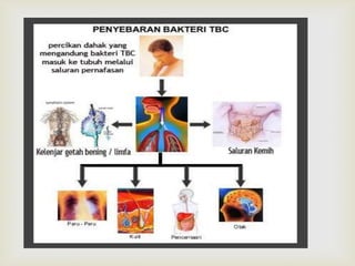 271308054-ppt-penyuluhan-tbc-ppt.ppt