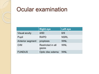 Proptosis : A Rare Presenting Feature Of Multiple Myeloma. | PPT