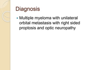 Proptosis : A Rare Presenting Feature Of Multiple Myeloma. | PPT