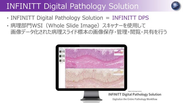 【インフィニットテクノロジー】INFINITT Digital Pathology Solution 病理画像管理システム | PPTX ...