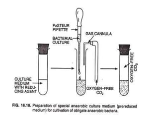 Anaerobic Bacteria Diagram