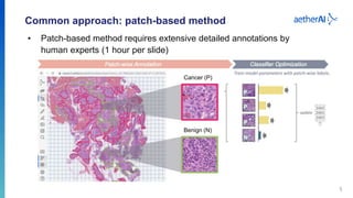 【aetherAI】AI-Assisted Diagnosis of Lymph Node Metastasis using GigaPixel AI technology | PPT