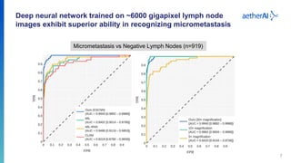 【aetherAI】AI-Assisted Diagnosis of Lymph Node Metastasis using GigaPixel AI technology | PPT