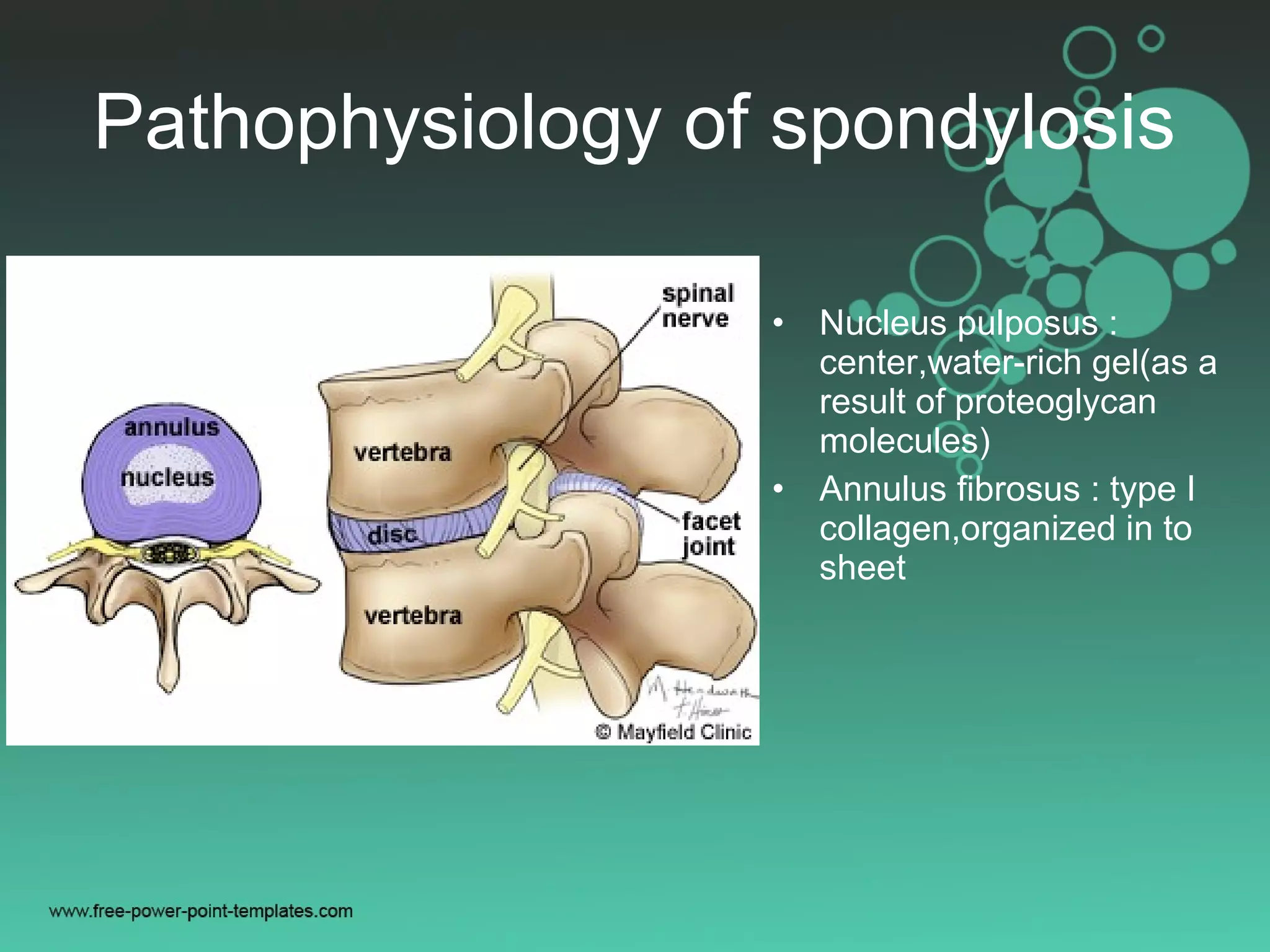 278 Treatment of disk and ligamentous diseases of the cervical spine | PPT