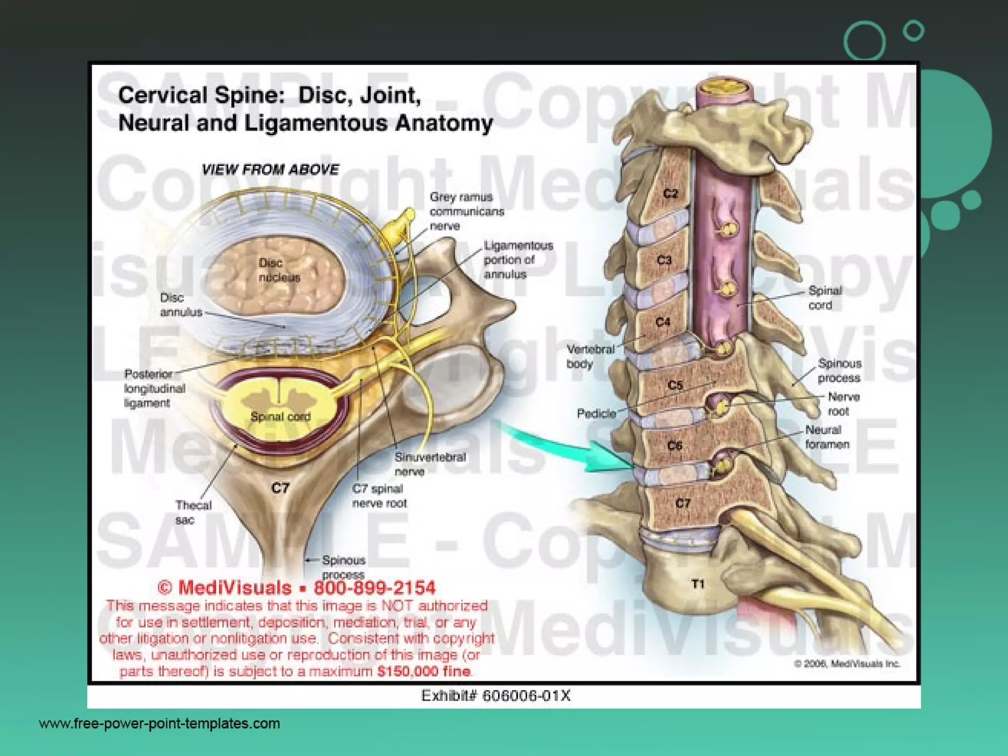 278 Treatment of disk and ligamentous diseases of the cervical spine | PPT