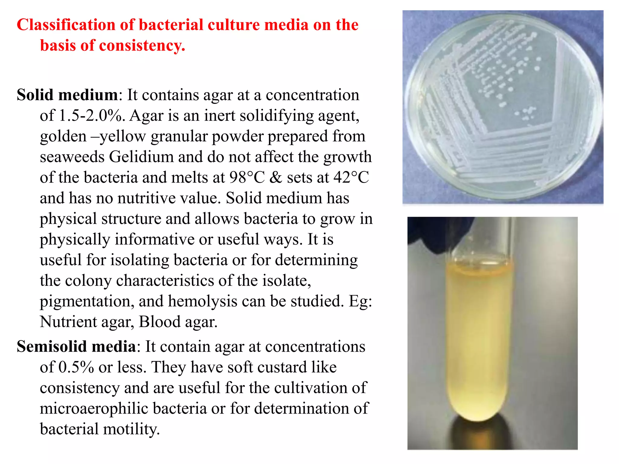Culture media used in Microbiology | PPT