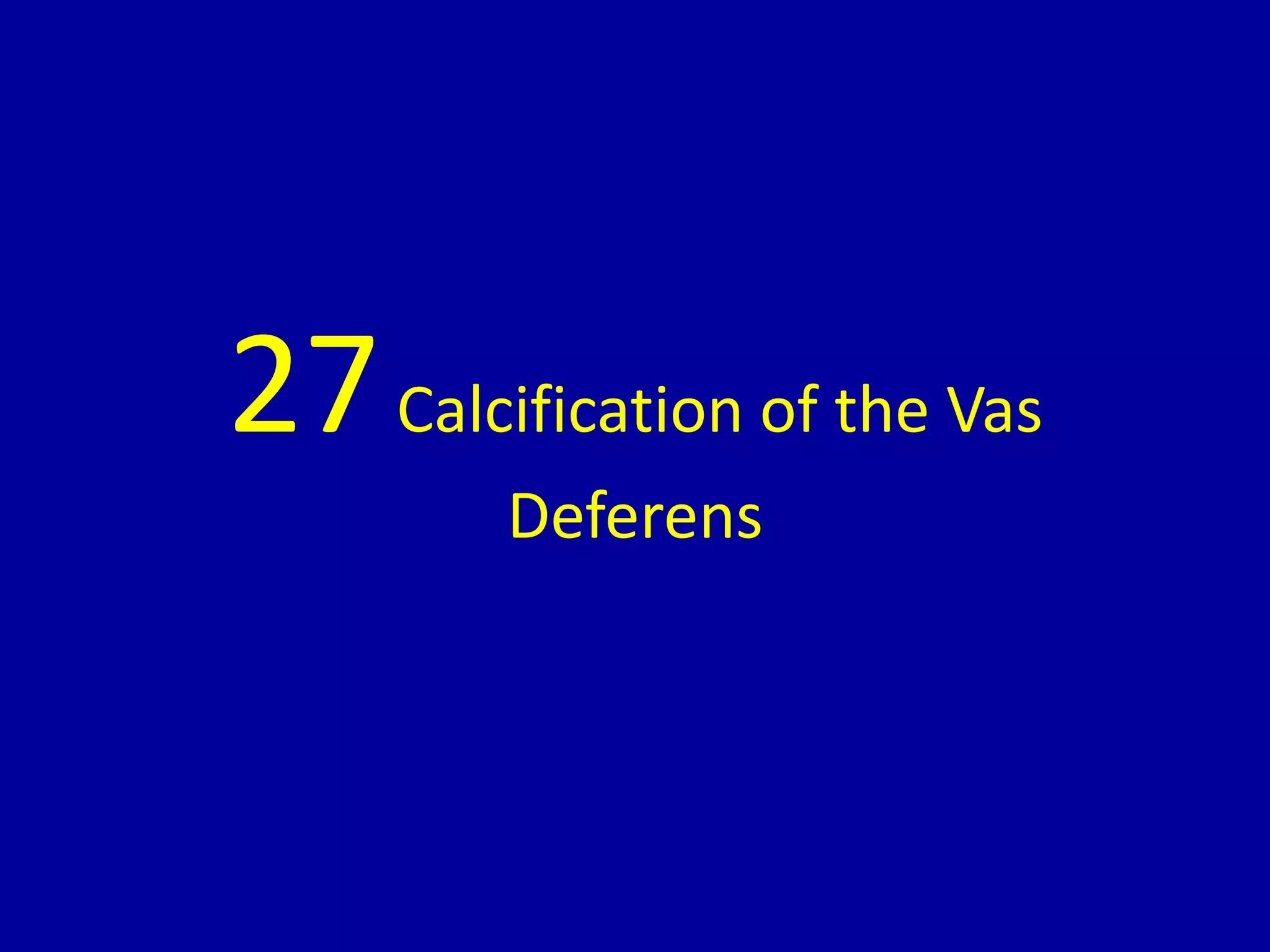 27 calcification of the vas deferens | PPTX