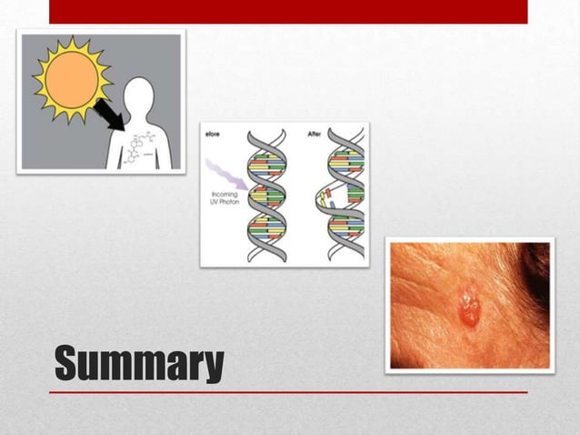 Pathophysiology of skin cancer | PPT