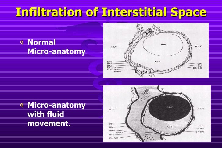 Management of Congestive Heart Failure: An Approach for the New Mille…