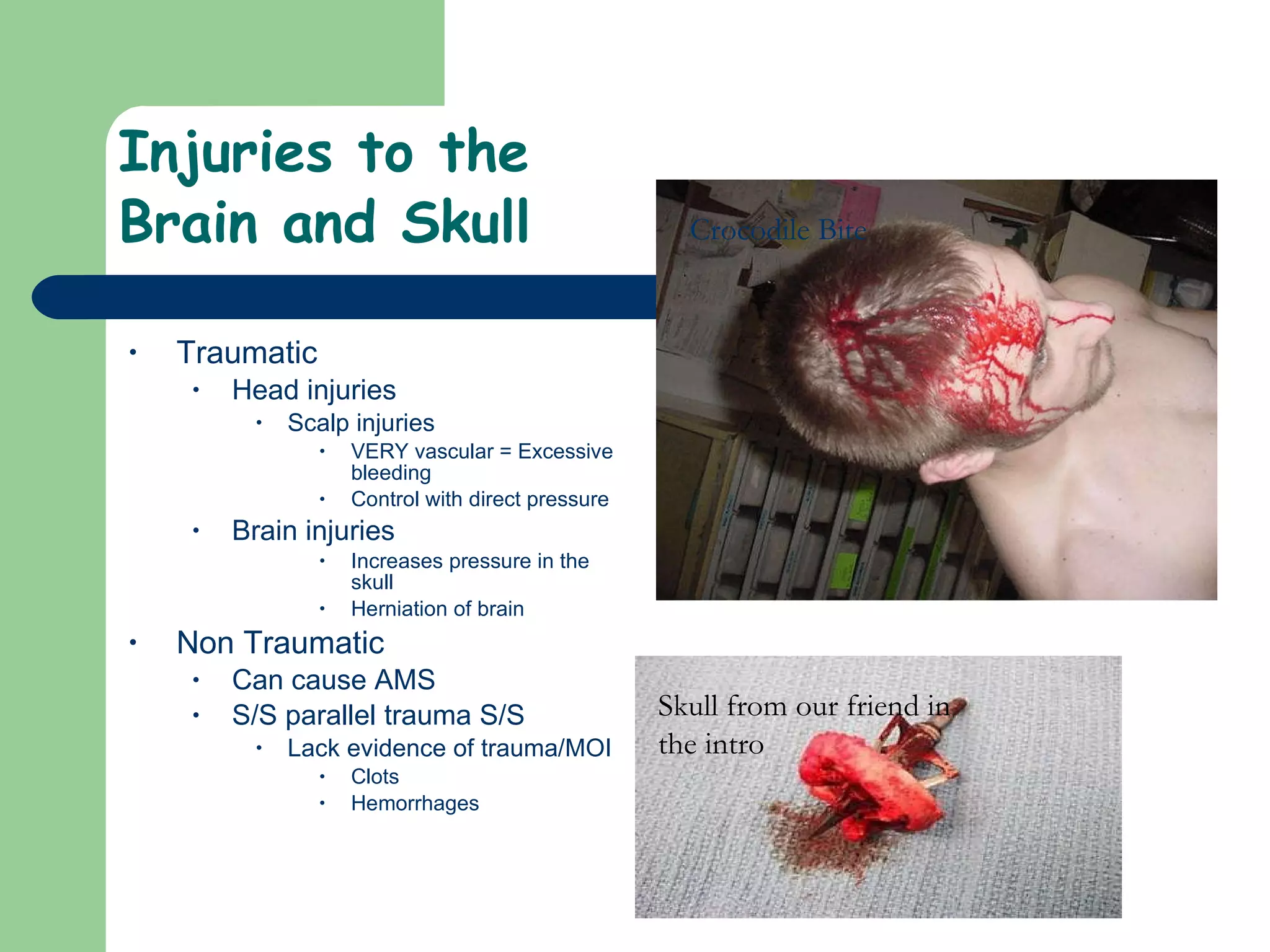 27)Injuries To The Head And Spine | PPT