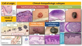 Melanoma | PDF