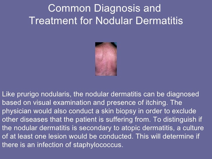 What You Need To Know About Nodular Dermatitis